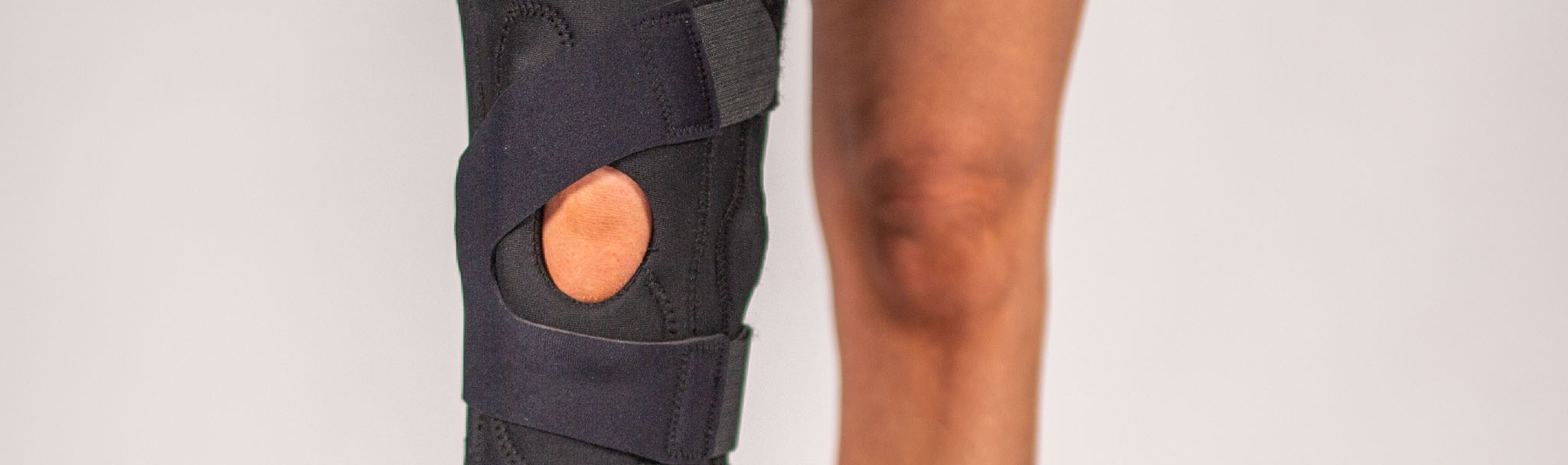 Hinged Lateral J - elizur